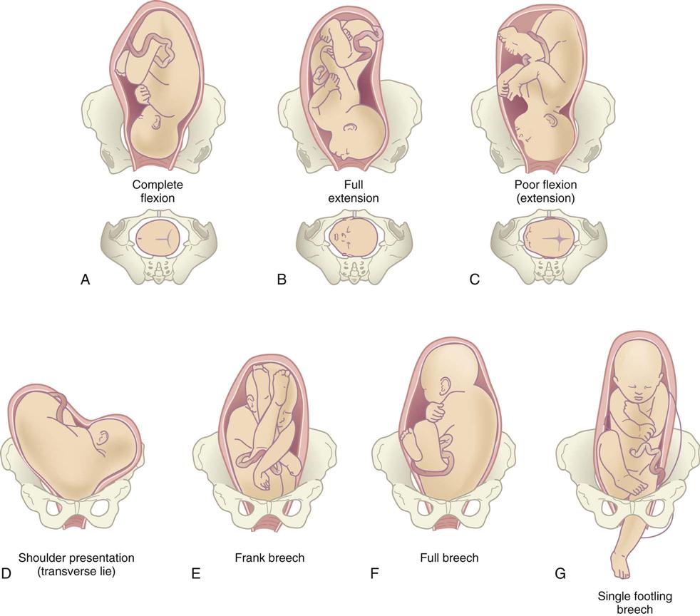The Fetal Presentation Is Cephalic The Fetal Presentation Is Cephalic