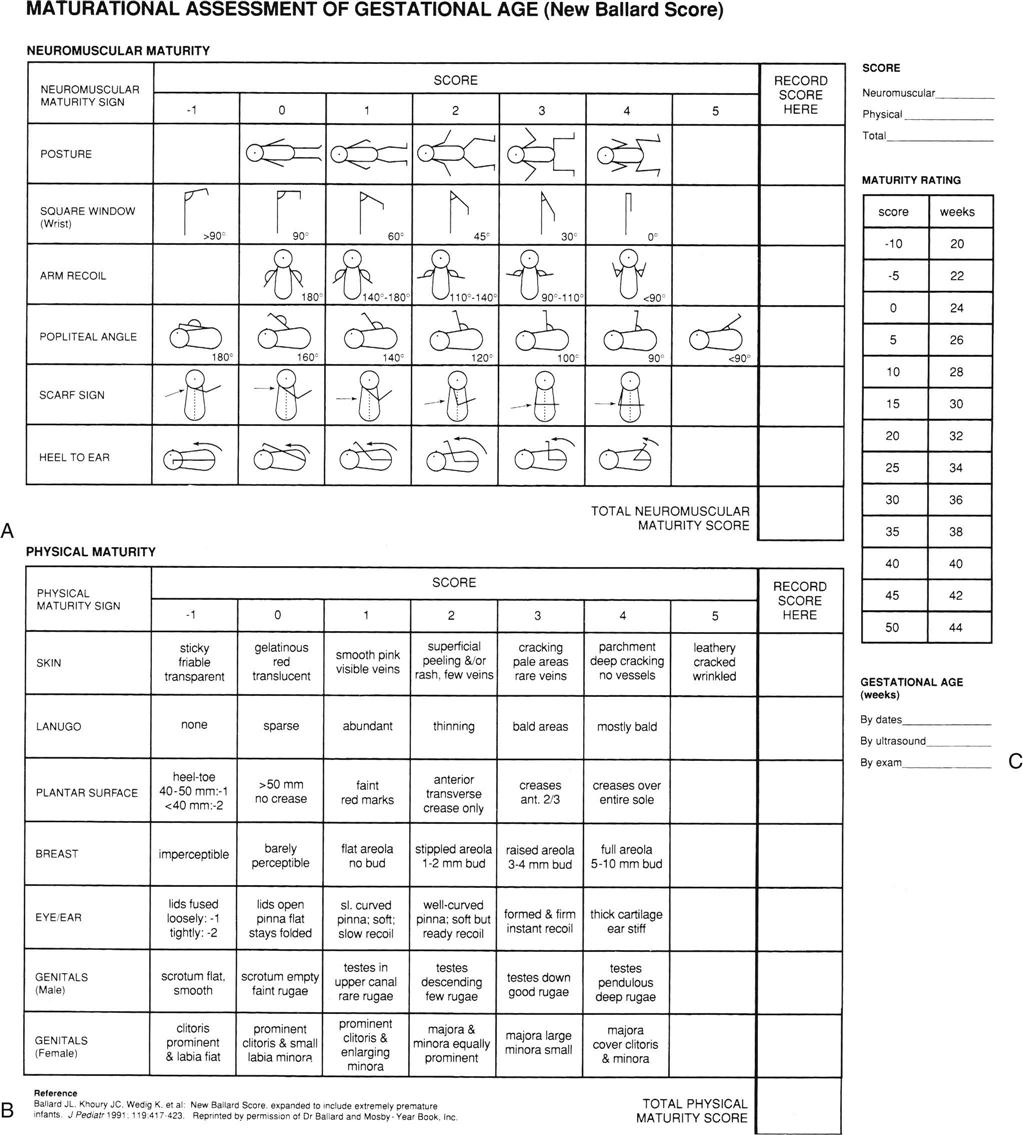 13 Preterm And Postterm Newborns Nurse Key