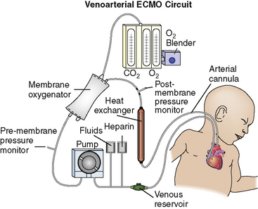 Mechanical Support Of Cardiopulmonary Function Extracorporeal Membrane