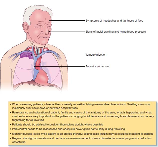 Emergencies Superior Vena Cava Obstruction Nurse Key